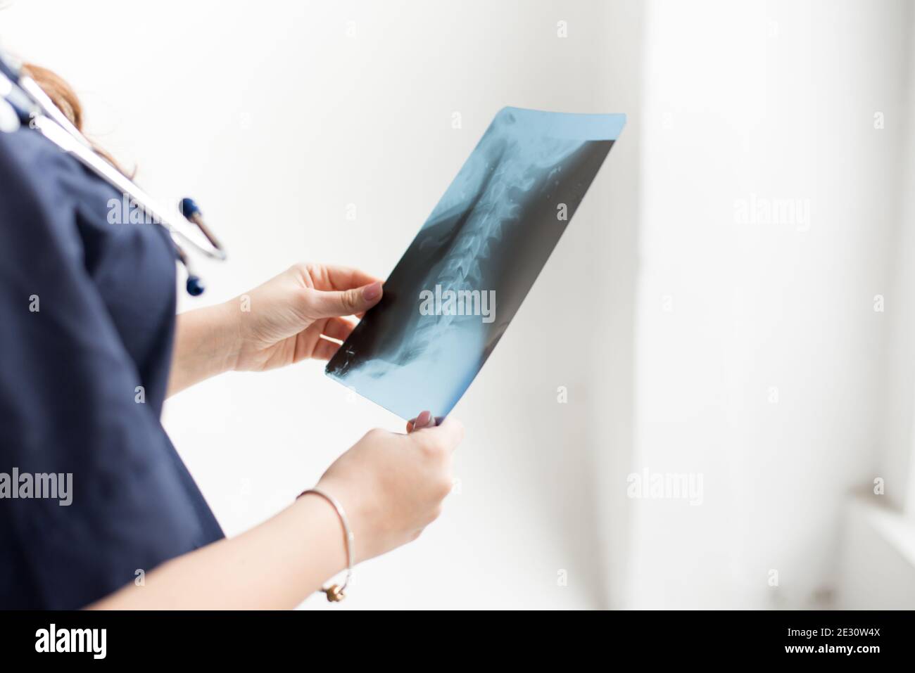 Doctor examining chest x-ray film of patient at hospital on white ...
