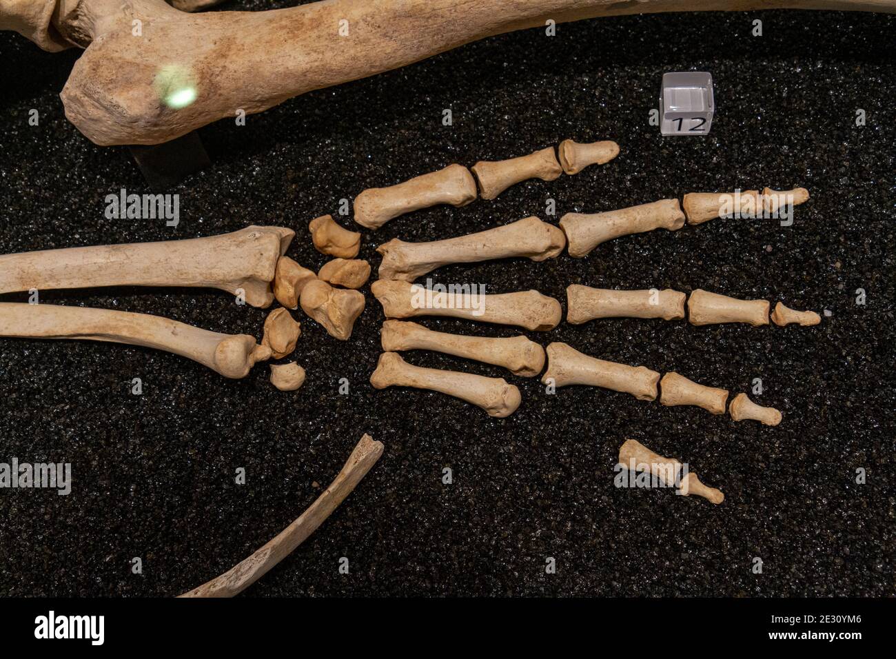 The right hand of Stonehenge Archer adult male skeleton (late neolithic ...