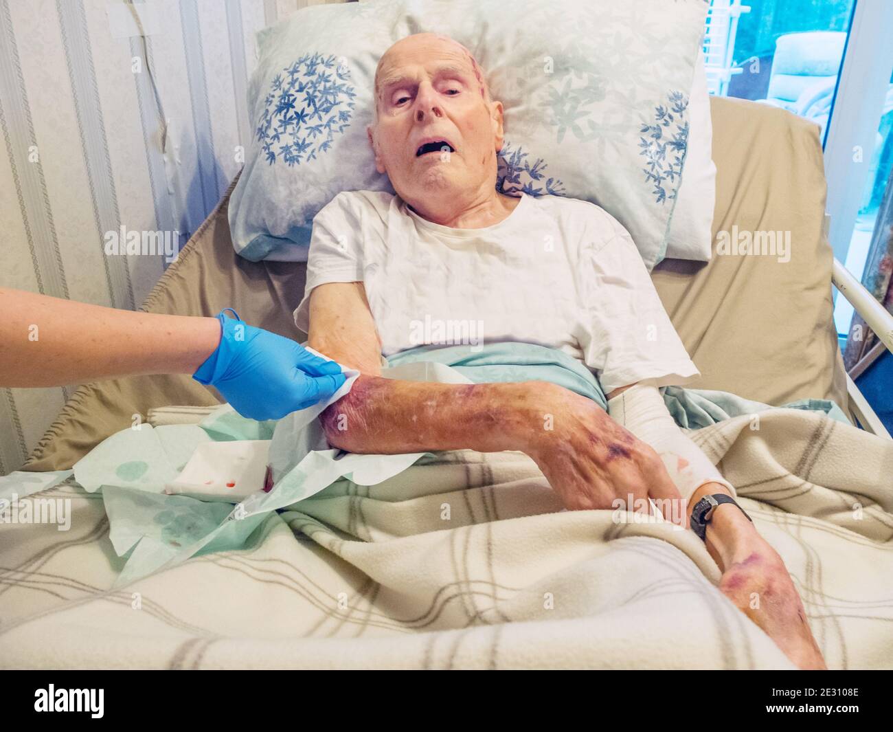 Accident arm bleeding blood bloody hi-res stock photography and images ...