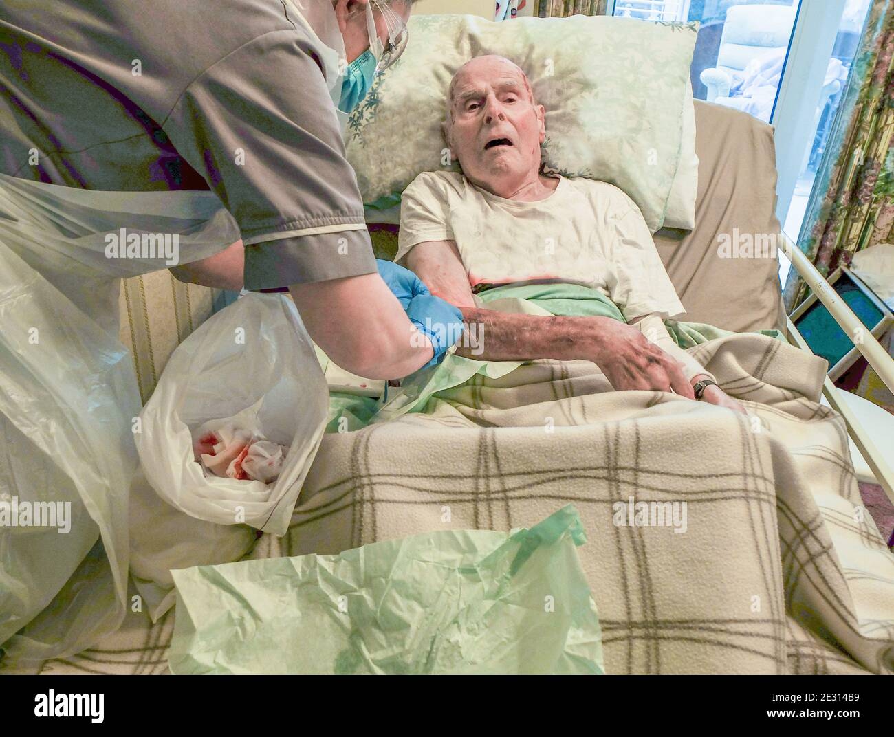 Skin injury hi-res stock photography and images - Alamy