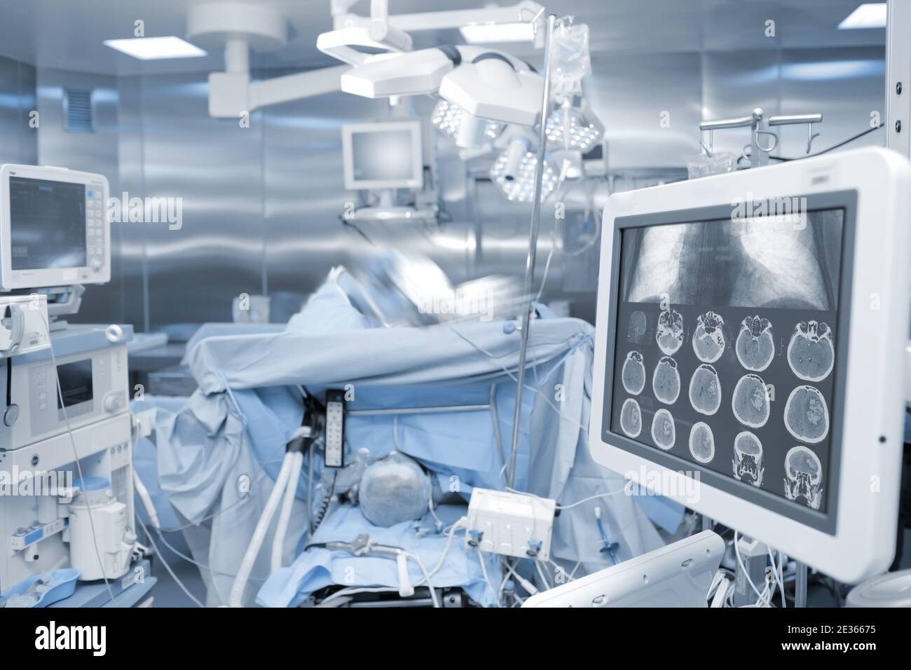 New age technology of x-ray control during surgery Stock Photo - Alamy