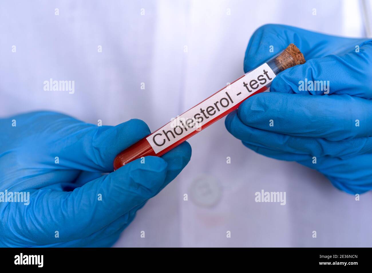 Cholesterol test hi-res stock photography and images - Alamy