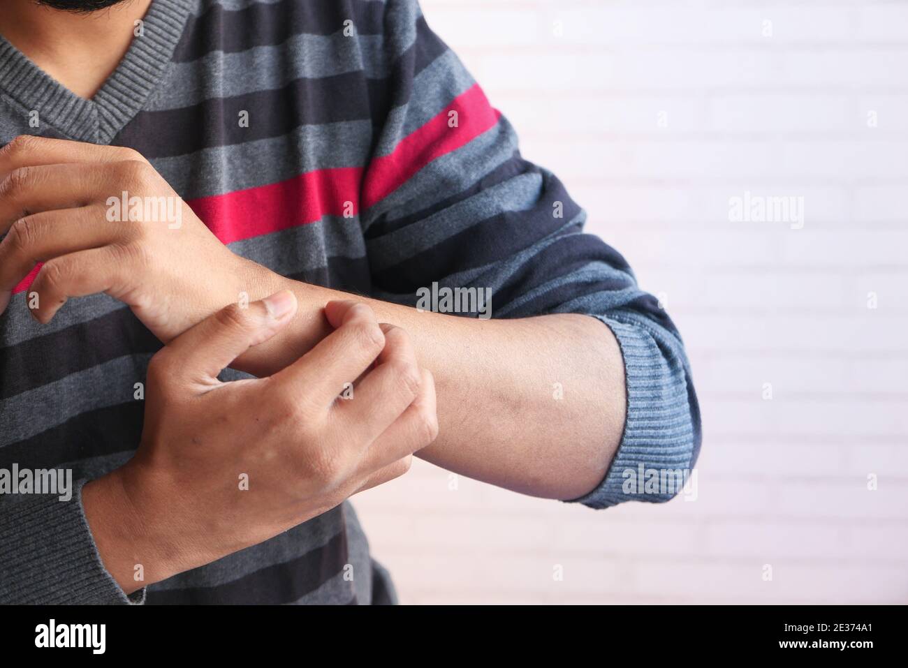 young man's hand suffering from itching skin Stock Photo - Alamy