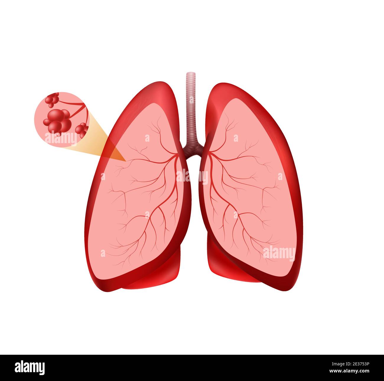 Location pulmonary alveoli clipart. Pink lungs with red vessels and ...