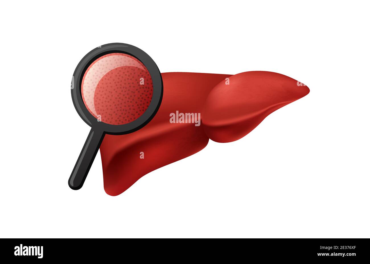 Examination of damaged liver cells. Enhances magnifier human red liver ...