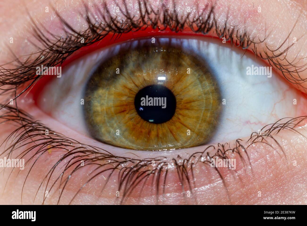 Healthy bright eyes hi-res stock photography and images - Alamy