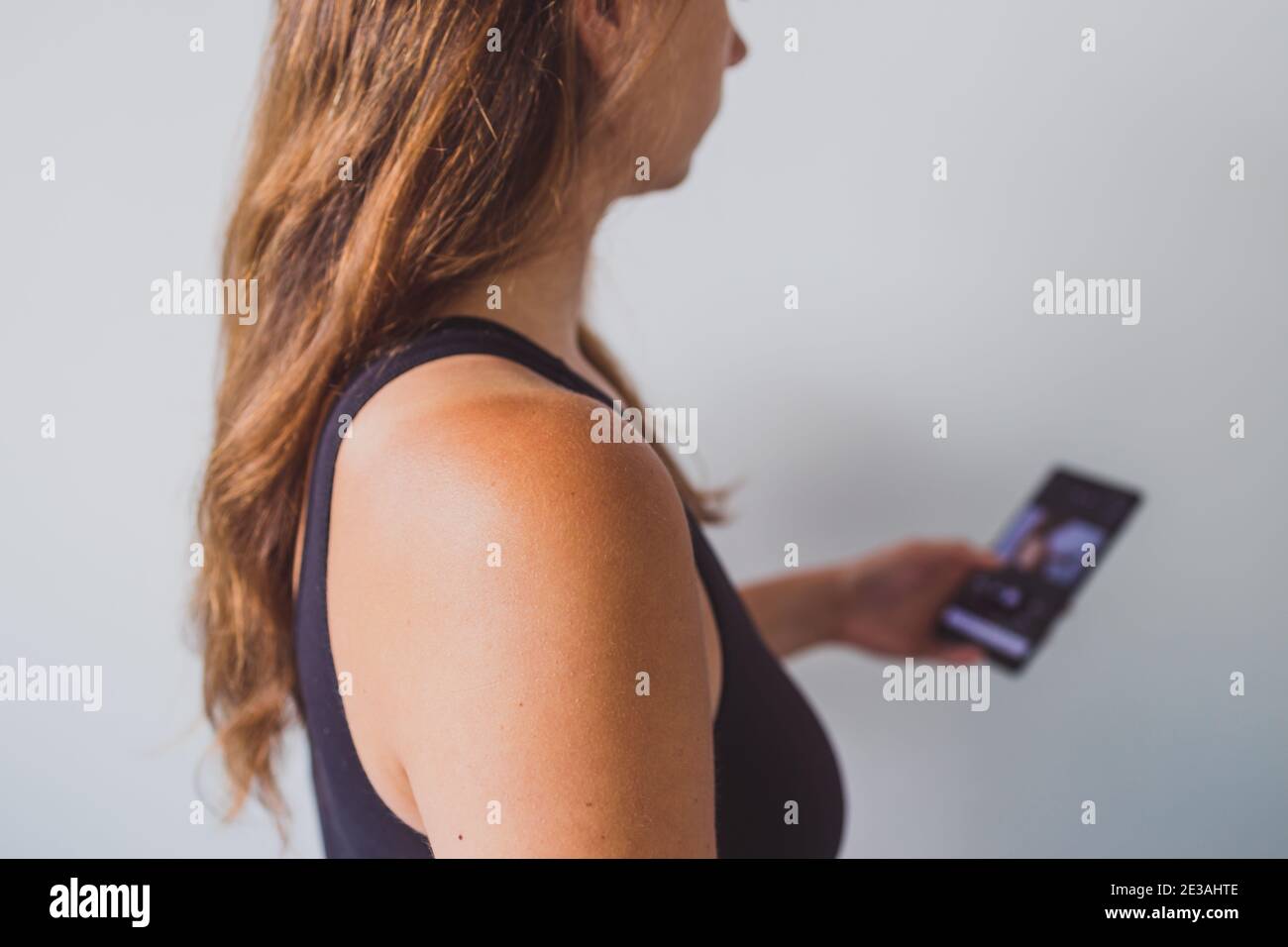 sun exposure and sunscreen use concept, girl revealing intense tan ...