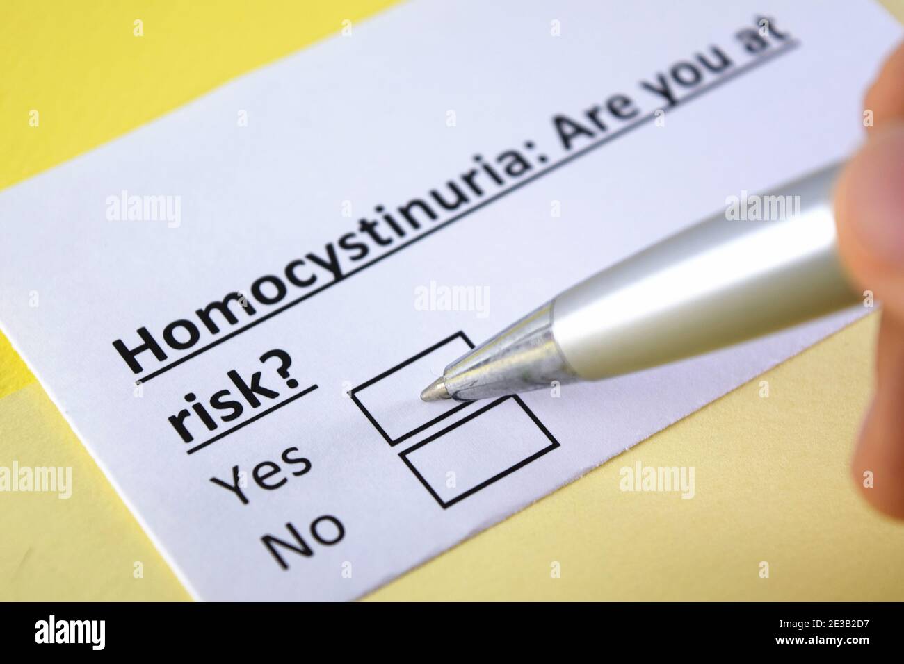 Homocystinuria hi-res stock photography and images - Alamy