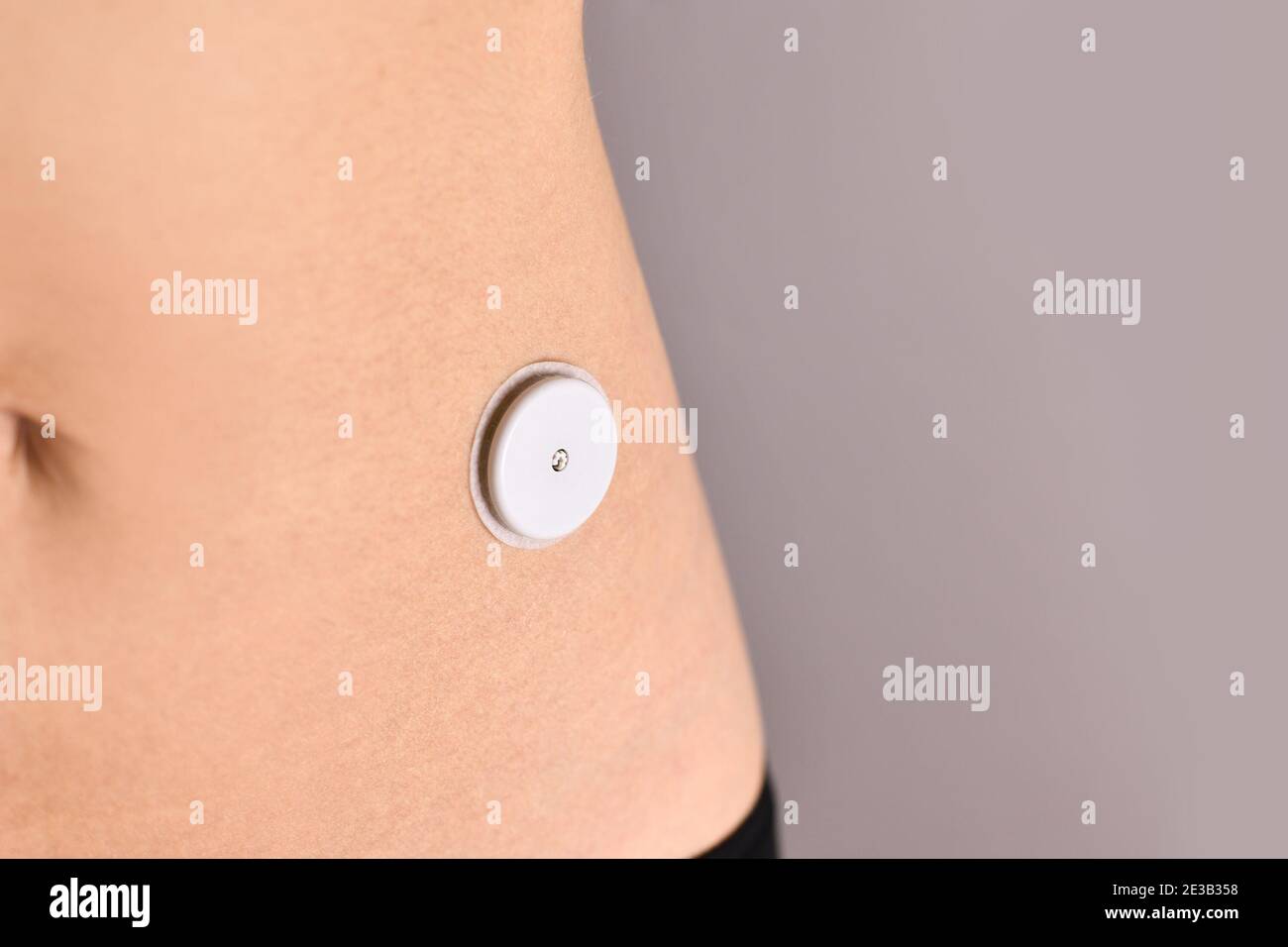 Sensor system for glucose monitoring attached to skin of person with ...