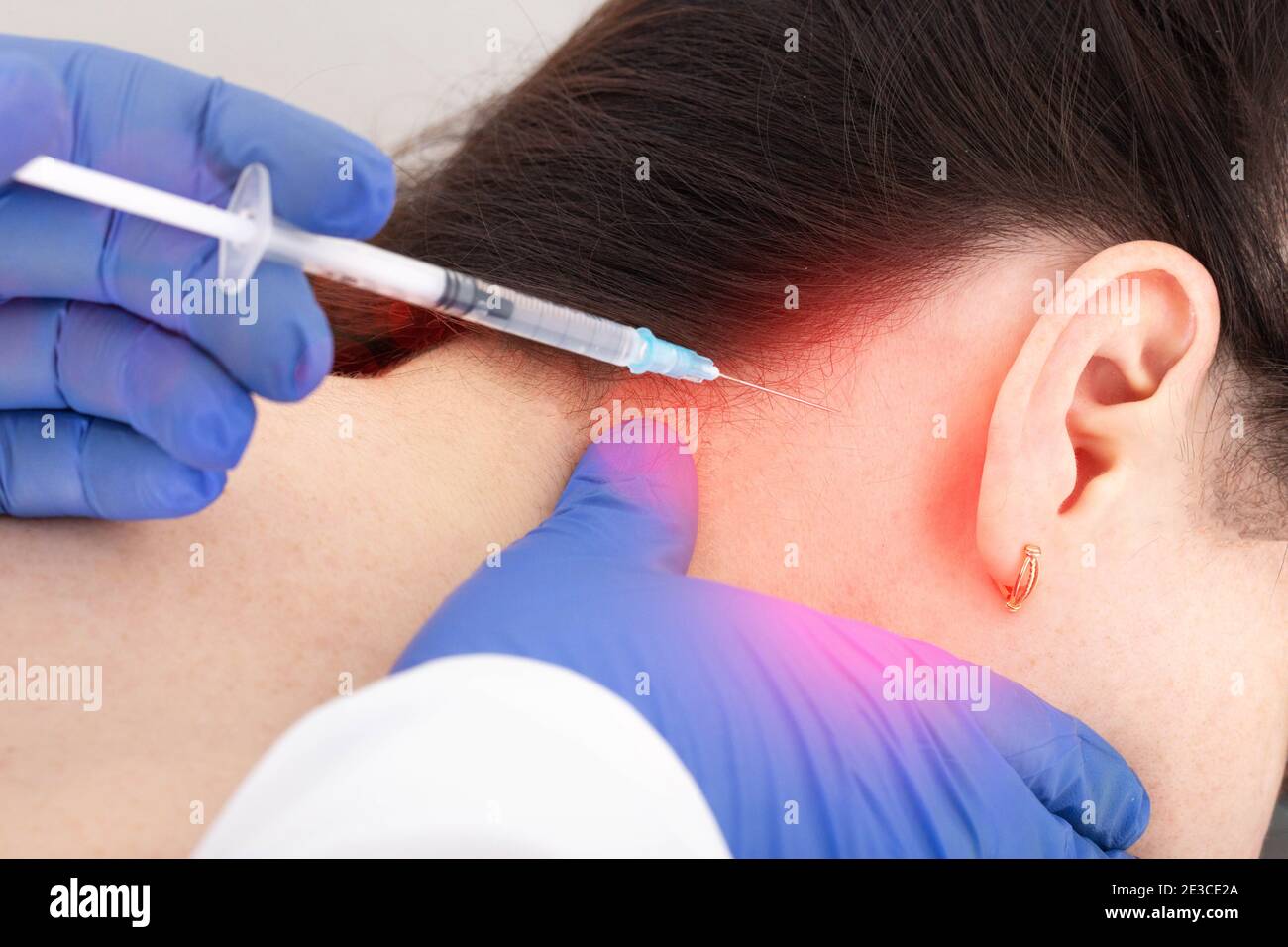 An otolaryngologist performs a BTE blockade on a patient with pain ...