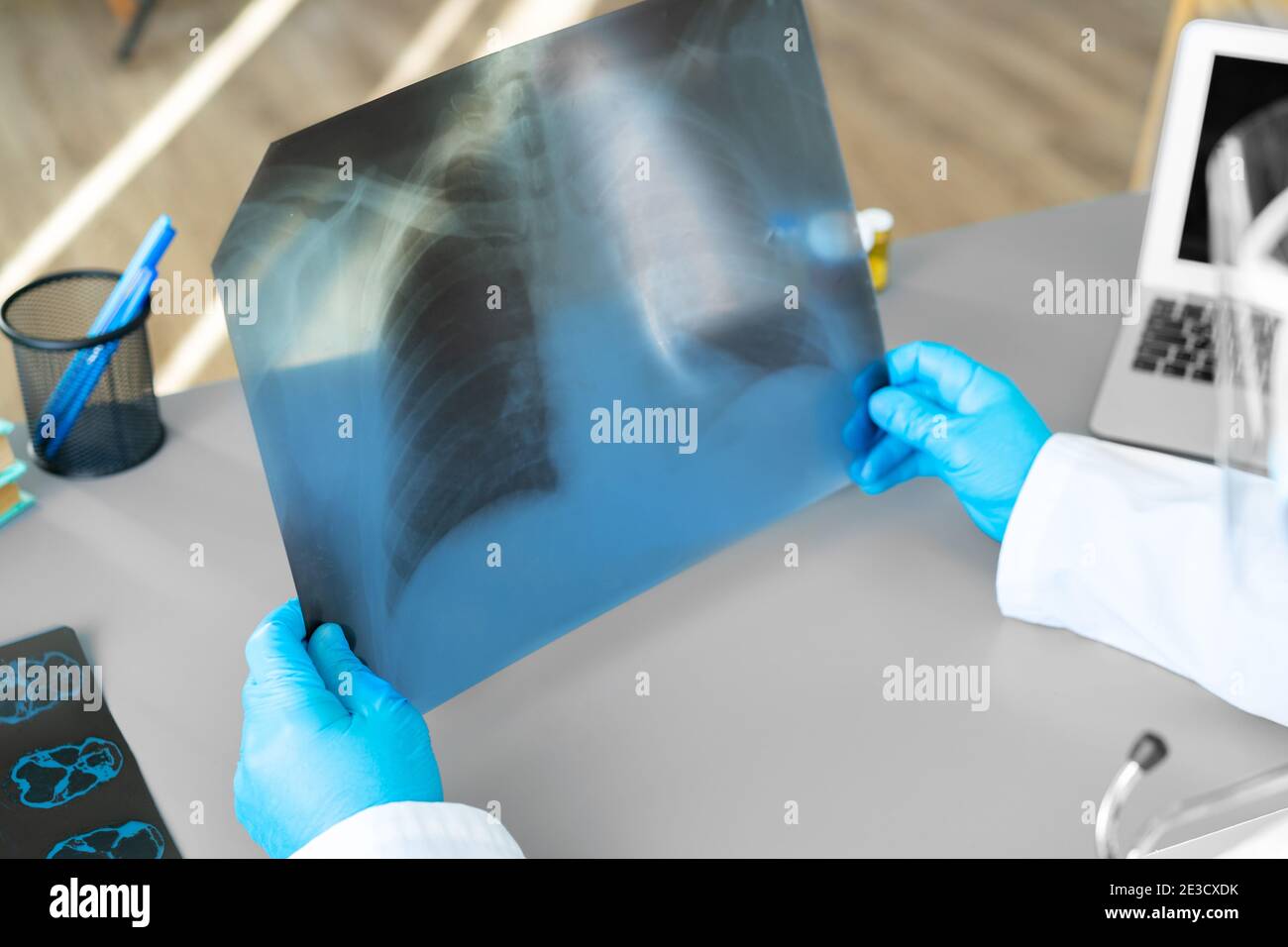 Doctor examining lungs x-ray scan in his office in hospital Stock Photo ...