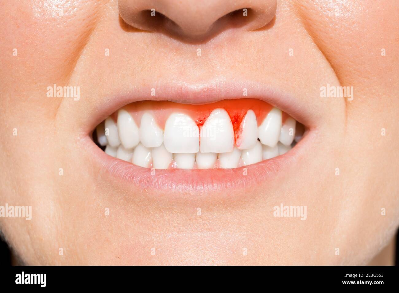 What To Do If Dog Has Bleeding Gums