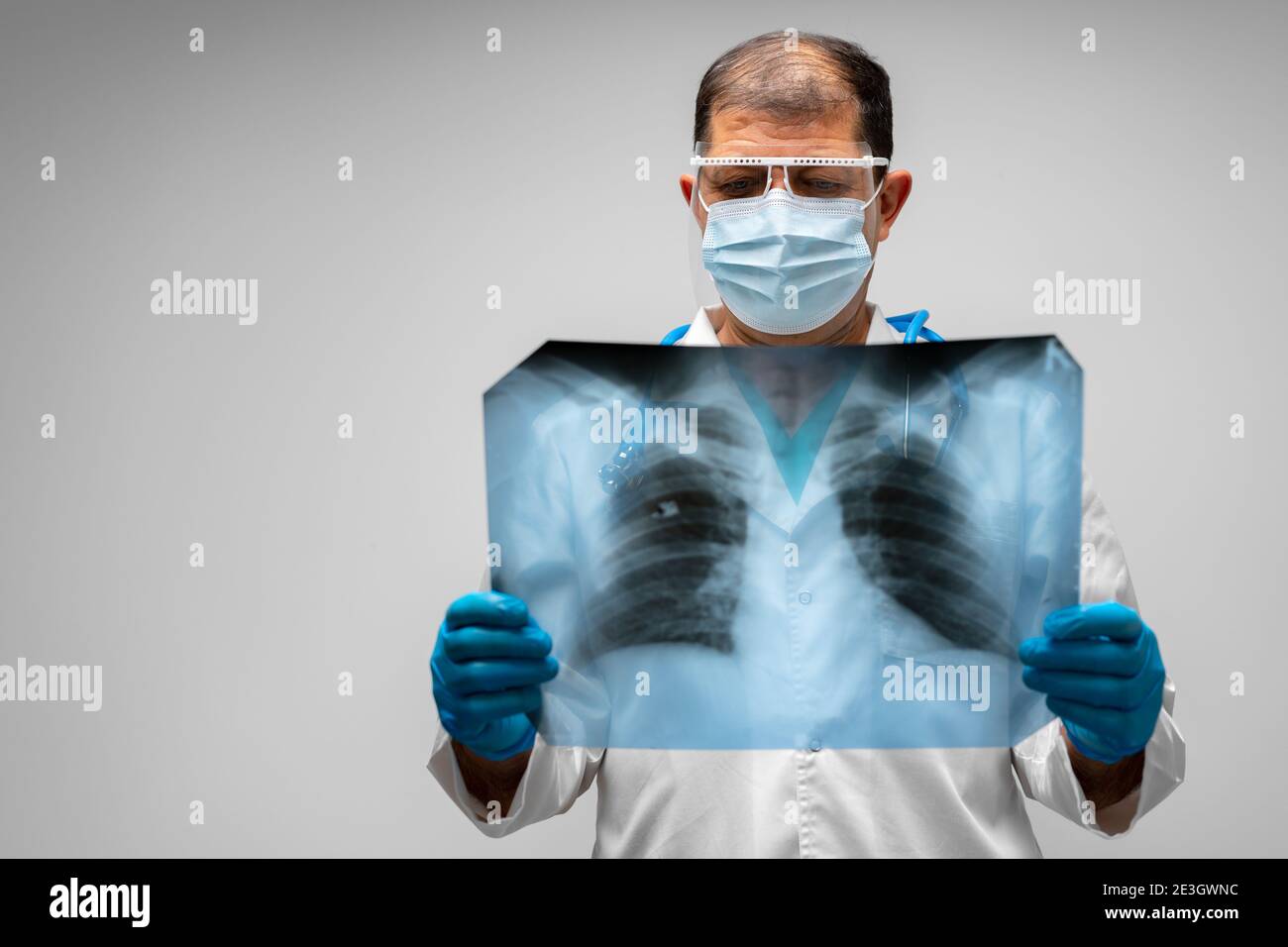 Male doctor examining lungs x-ray scan against grey background Stock ...