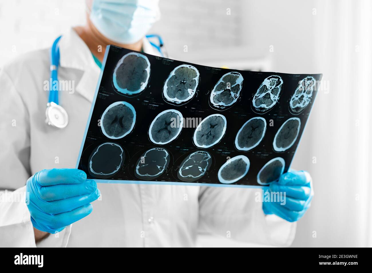 Hands of a doctor holding head mri scan Stock Photo - Alamy