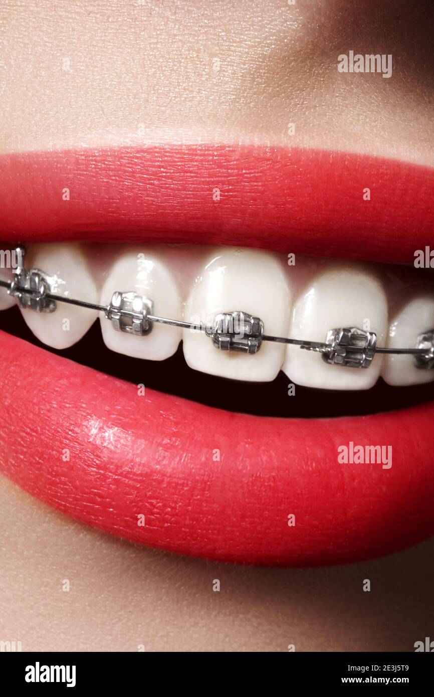 Red braces hi-res stock photography and images - Alamy