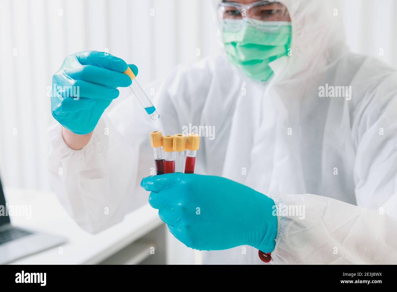 Researchers compare blood samples of patients infected with the disease ...