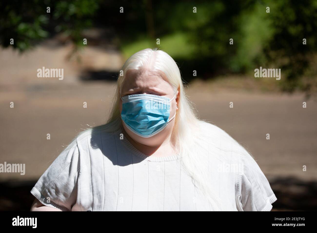 Close up of an albino woman wearing a medical mask Stock Photo - Alamy