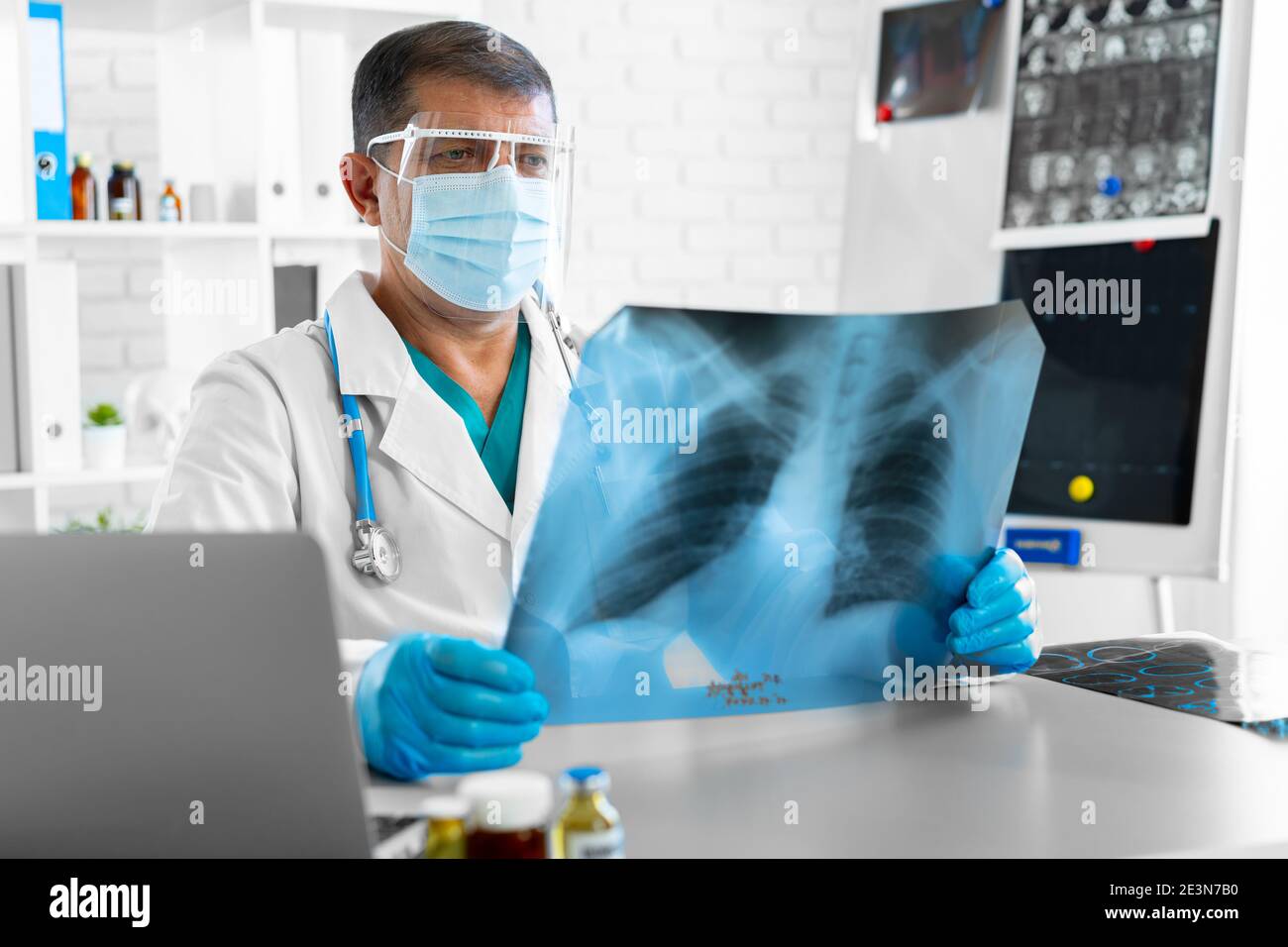 Doctor examining lungs x-ray scan in his office in hospital Stock Photo ...
