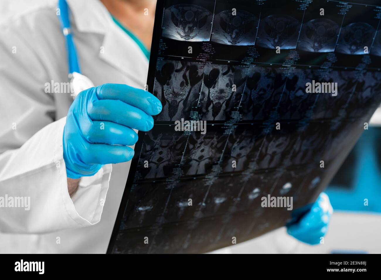 Hands of a doctor holding head mri scan Stock Photo - Alamy