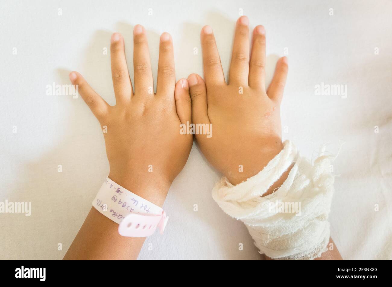 Swelling hands hi-res stock photography and images - Alamy