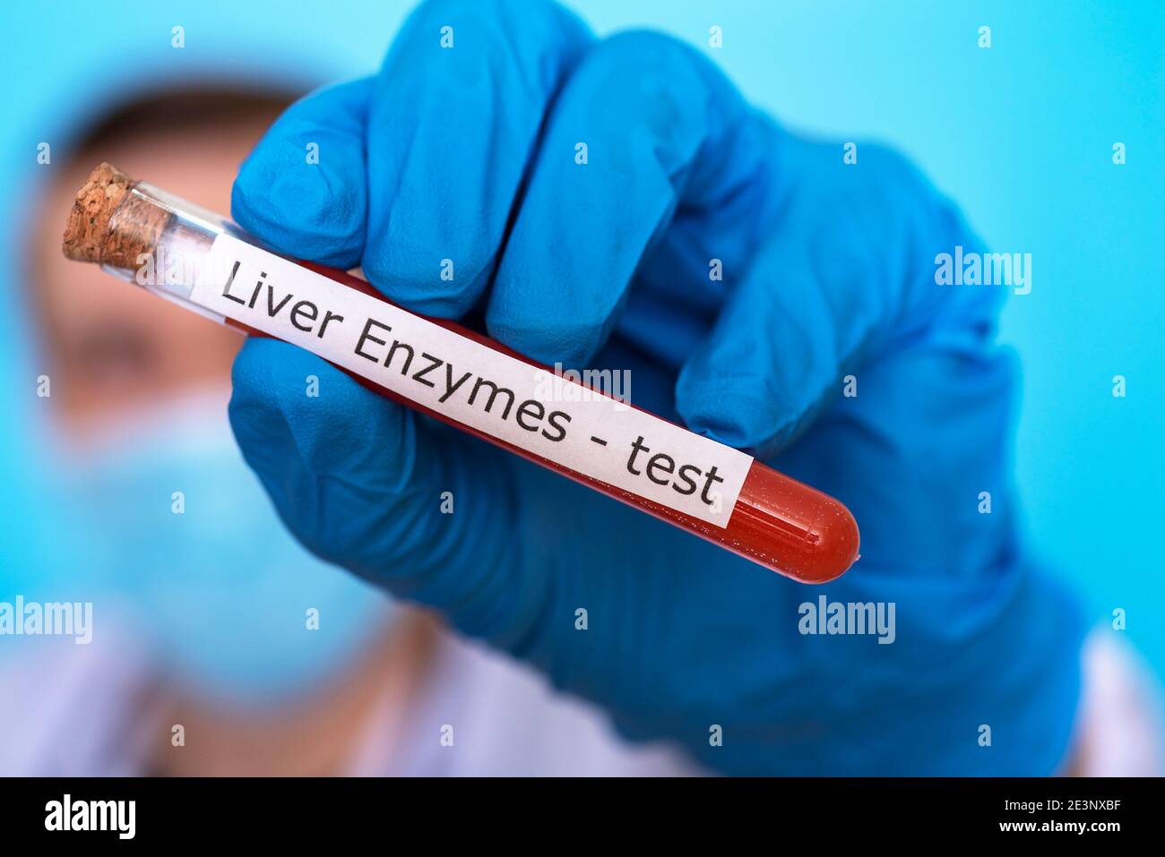 Liver Enzymes