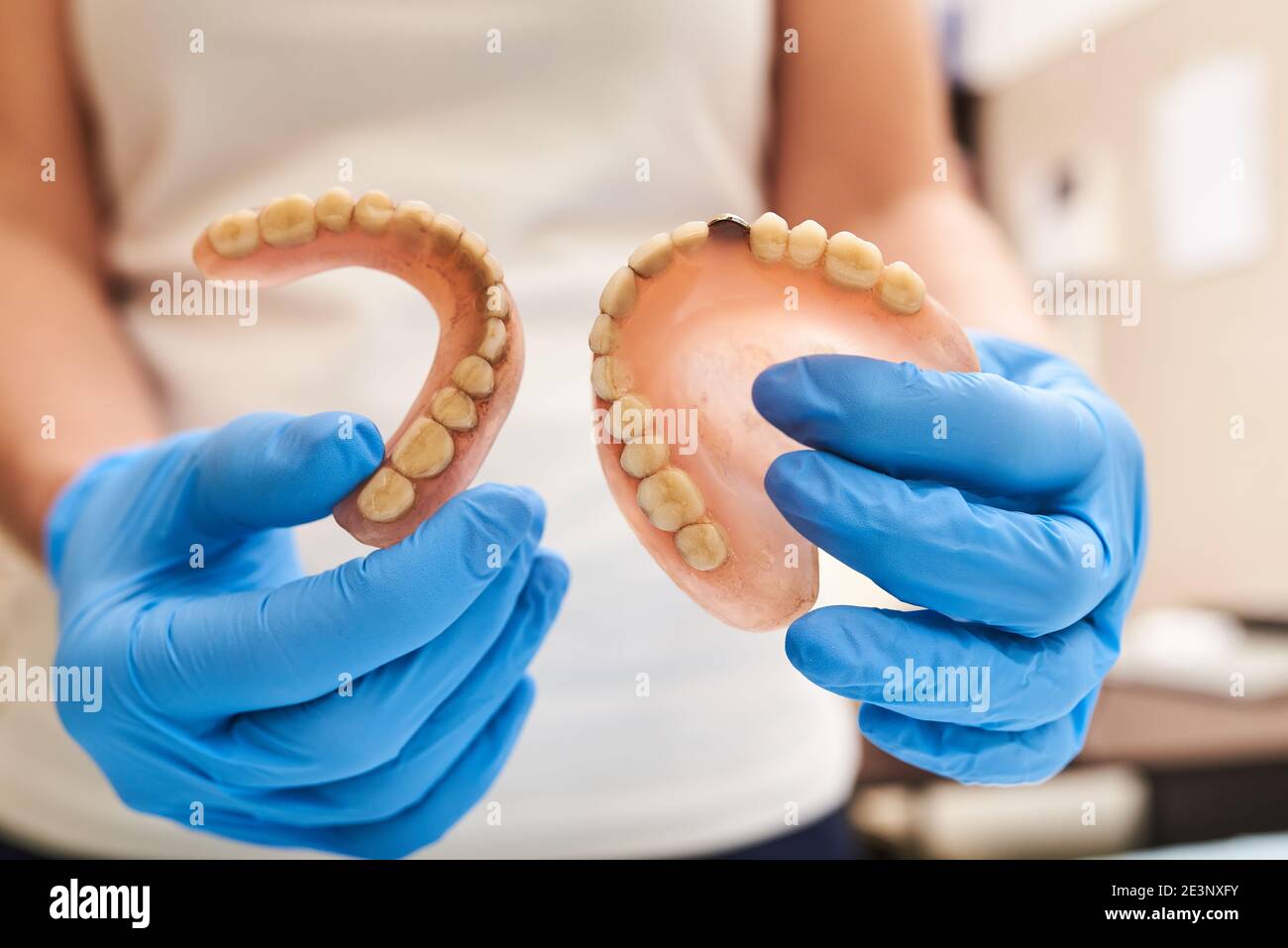 Dental surgery. Old dental prosthesis in medical hands before ...