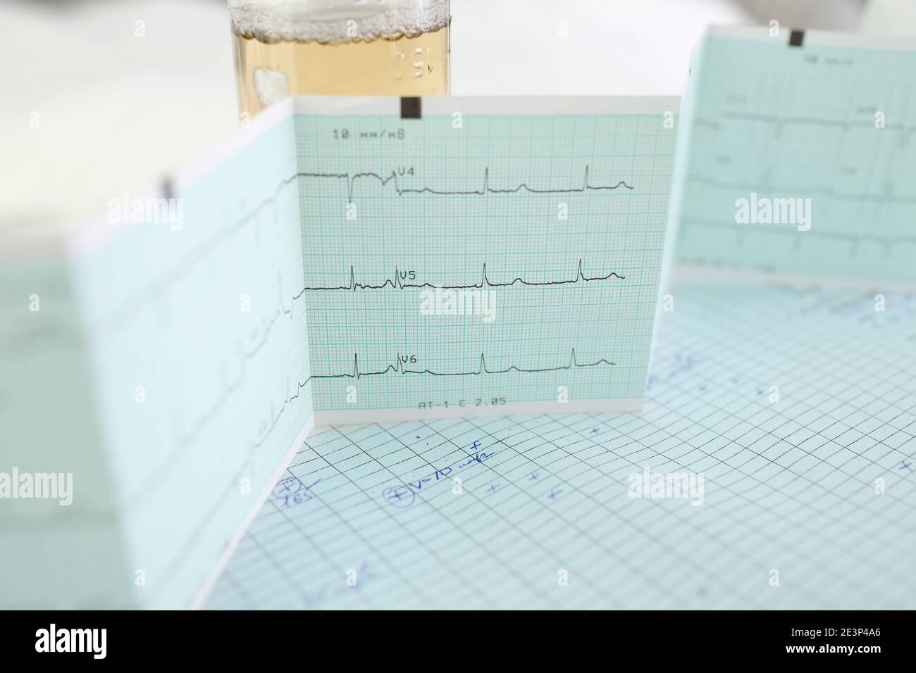 Medical examination results on the doctor's table in the office Stock ...