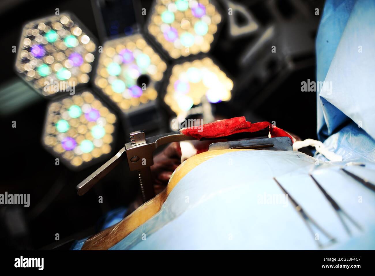 Operating theatre with surgeon working in the surgical field Stock ...