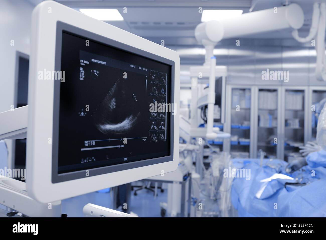 Echocardiography hi-res stock photography and images - Alamy