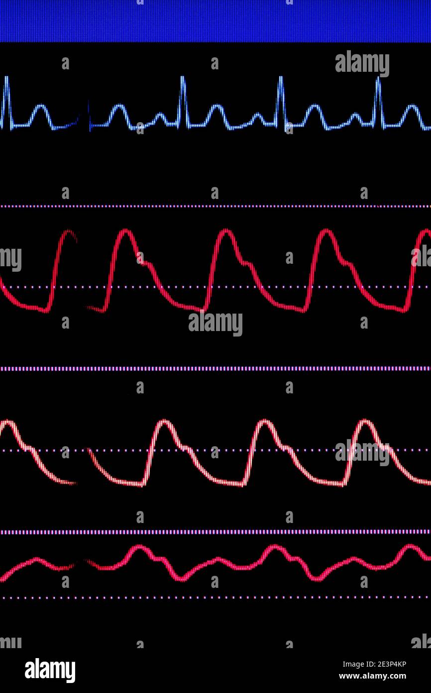 Heart monitoring hi-res stock photography and images - Alamy