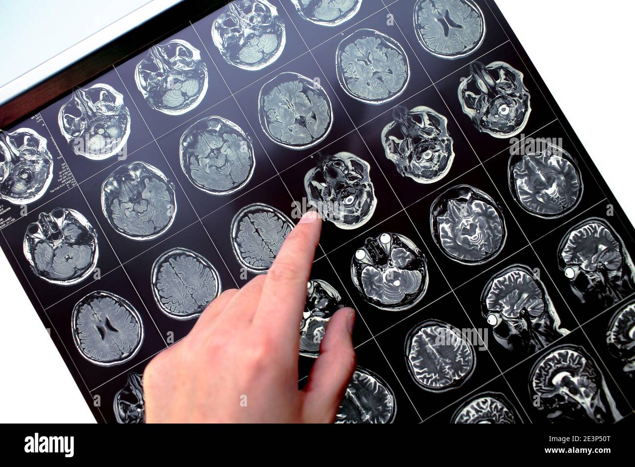 Mri brain activity hi-res stock photography and images - Alamy