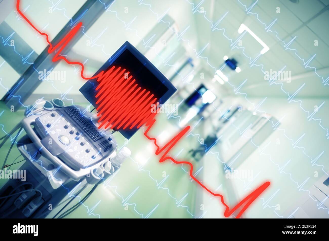 ECG lines on the background of medical technique in the hospital ...