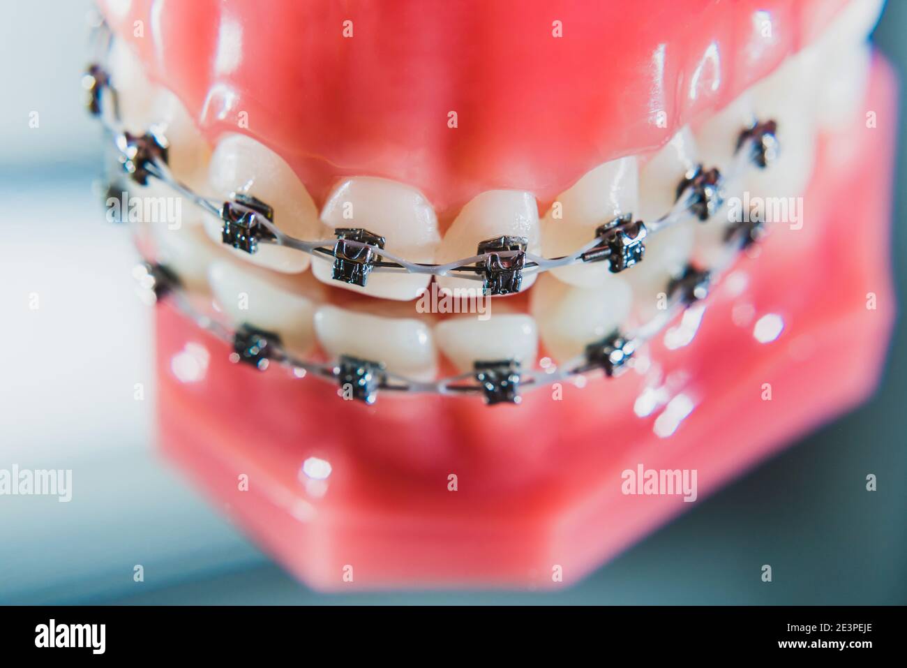 macro photography shows how the braces are arranged Stock Photo - Alamy