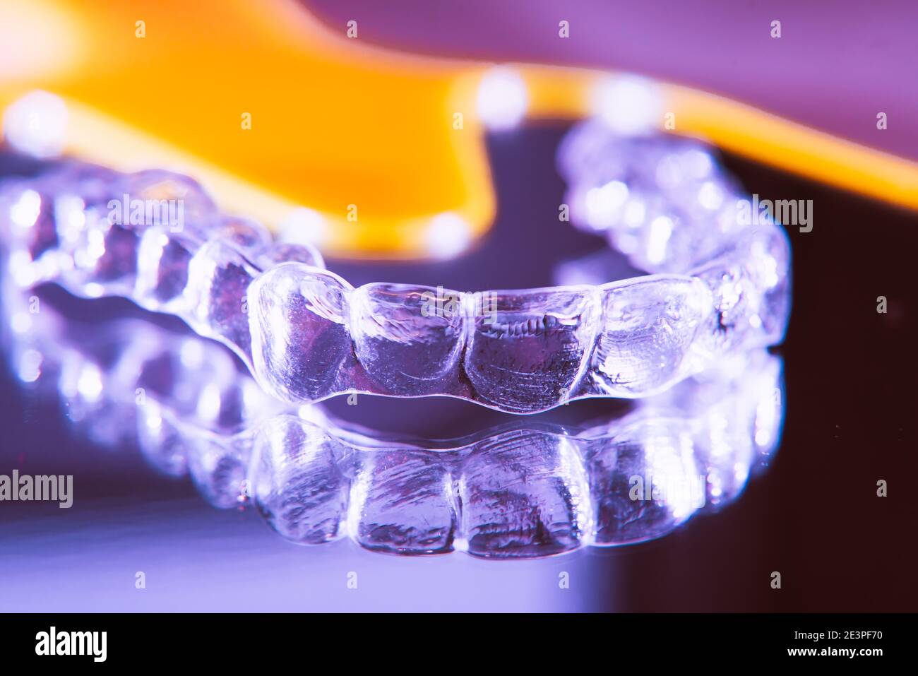 Purple Braces For Teeth