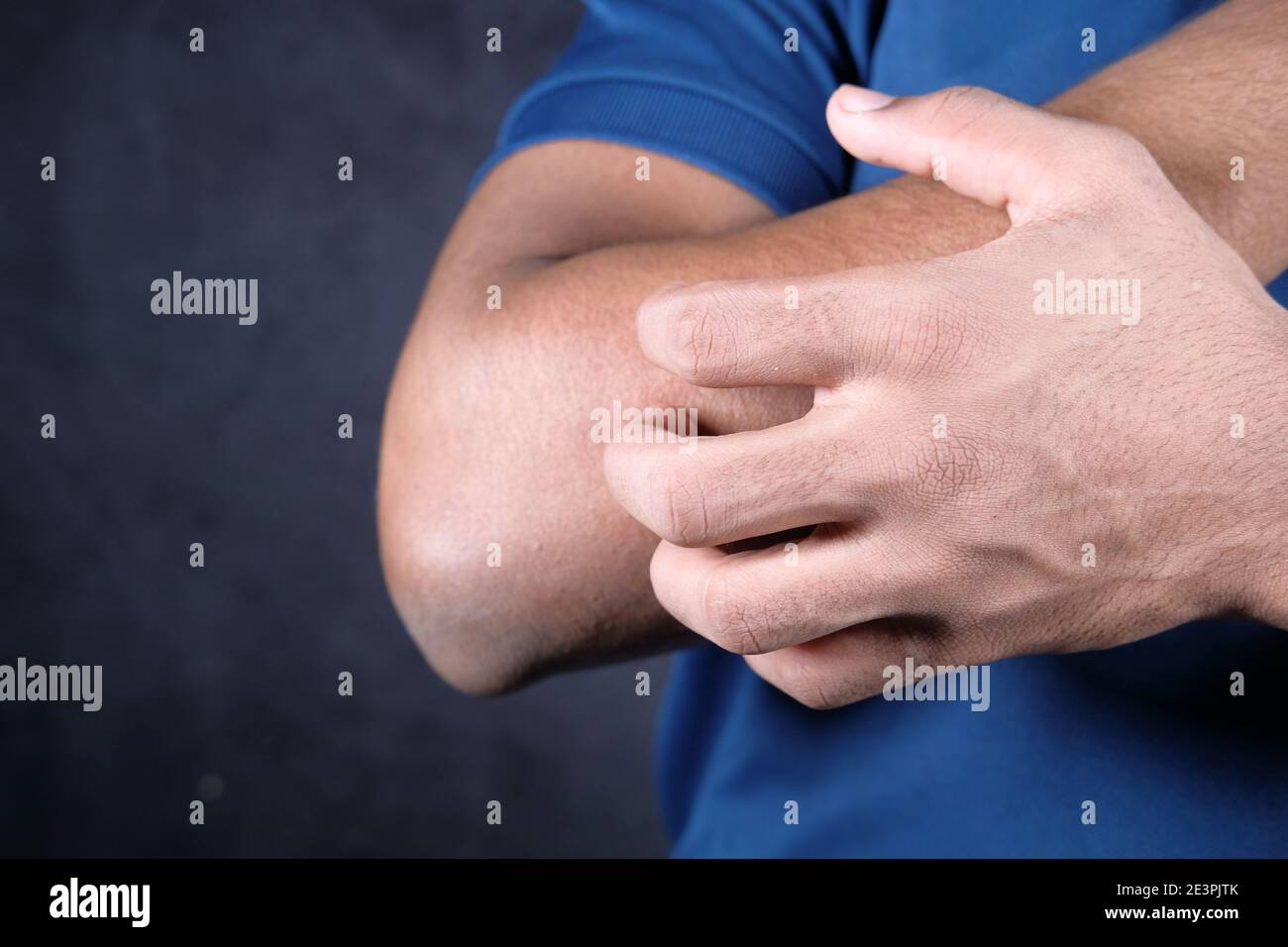 man suffering from itching skin, close up Stock Photo - Alamy
