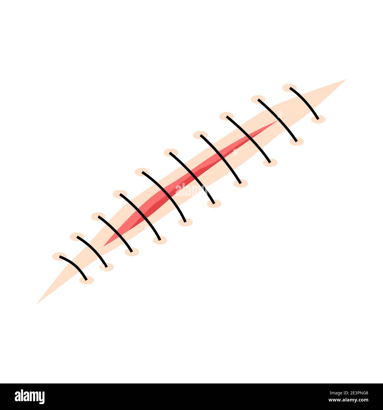 Cut suture scar vector icon. First aid injury stitch skin concept wound Stock Vector Image & Art ...
