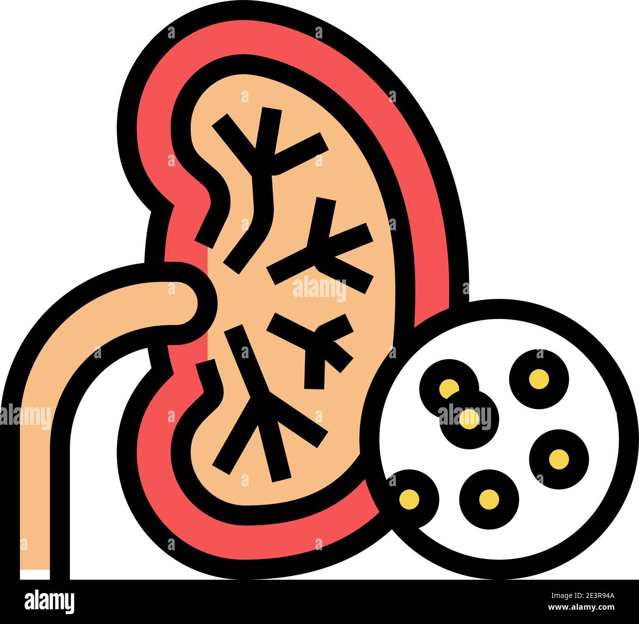 kidneys problem color icon vector illustration Stock Vector Image & Art ...