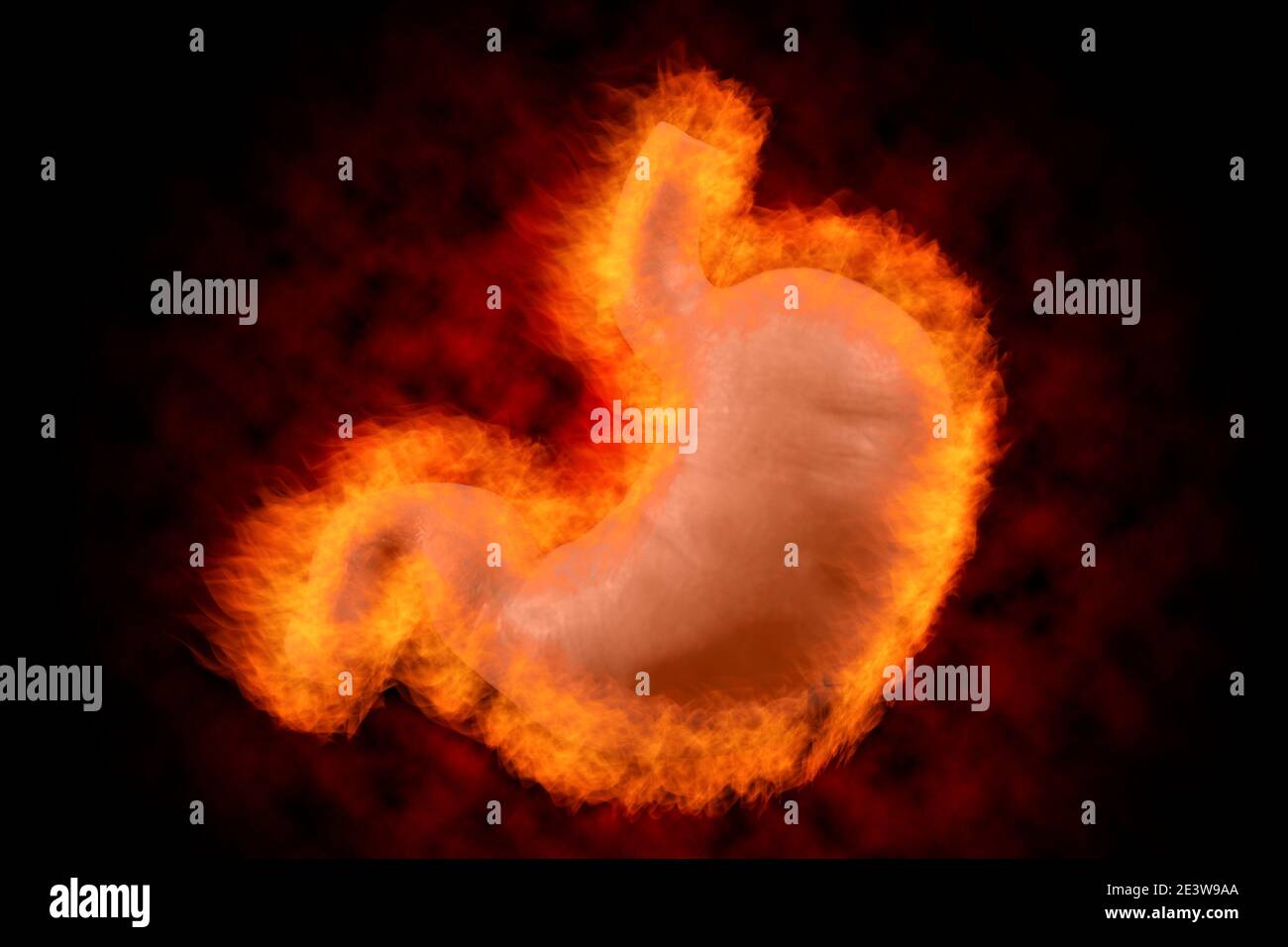Acute abdominal pain, heartburn and indigestion, peptic ulcer and ...
