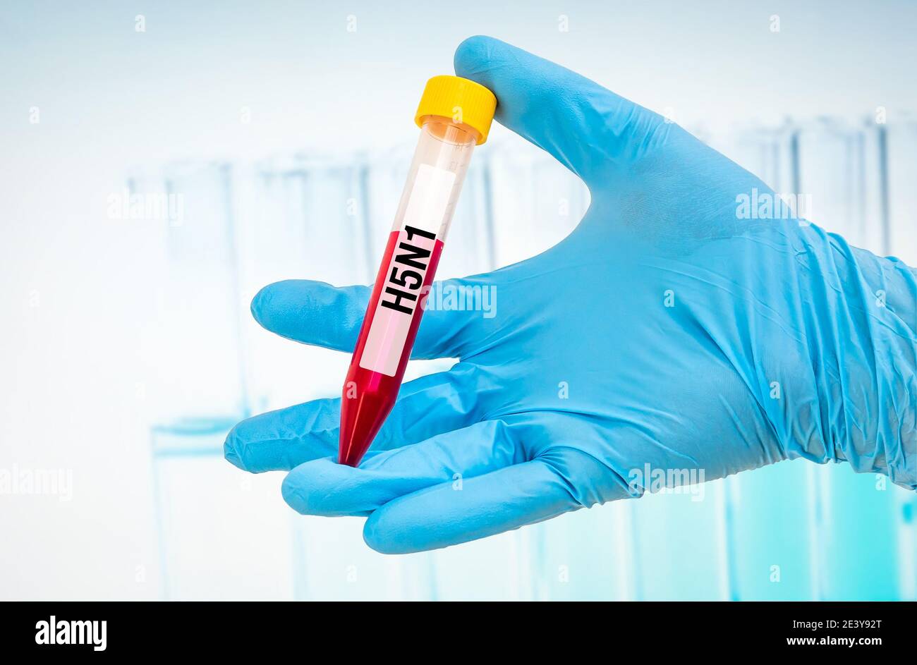 Scientists hand holding a test-tube with blood sample for H5N1 test ...