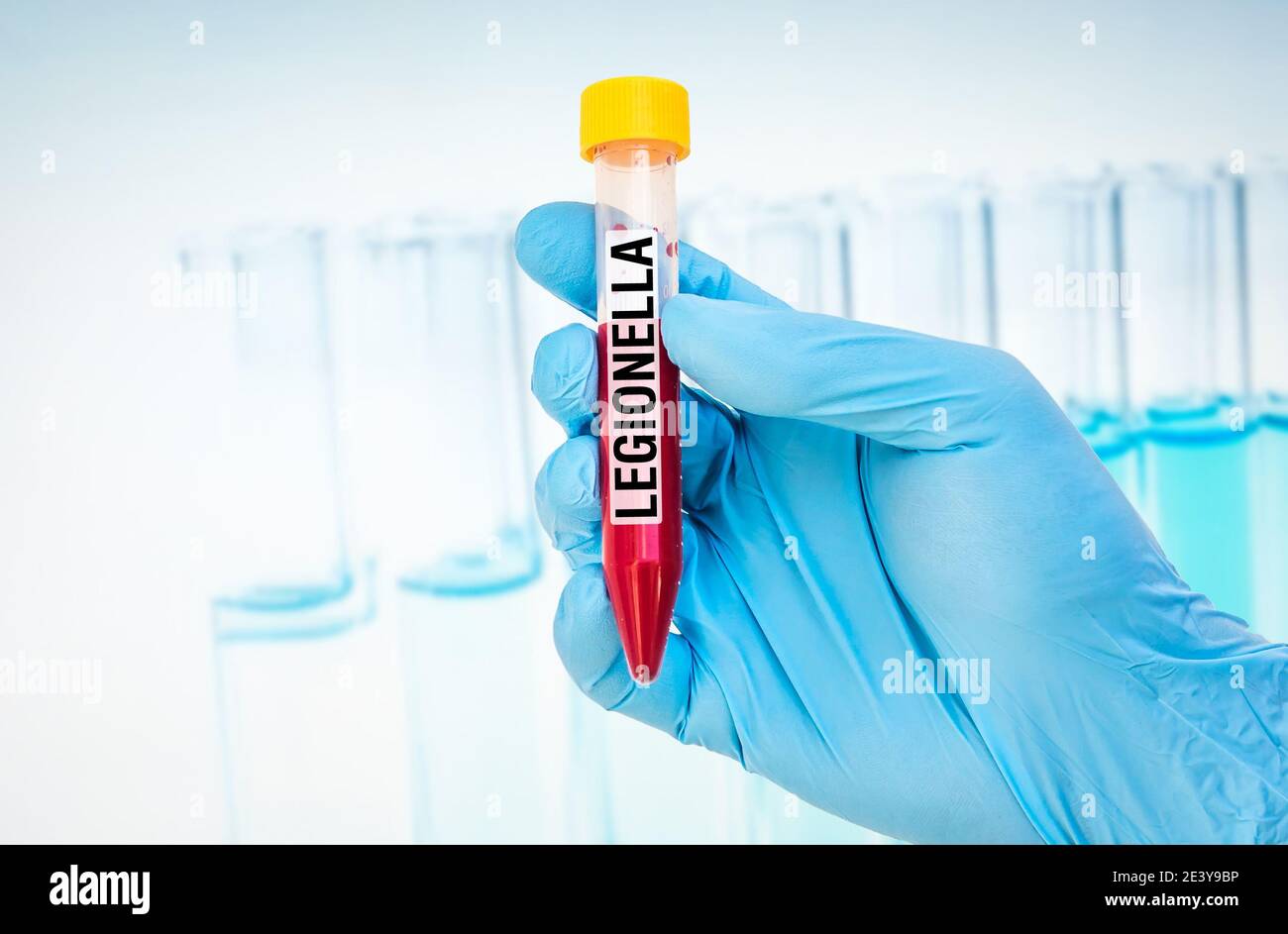 Scientists hand holding a test-tube with blood sample for LEGIONELLA ...