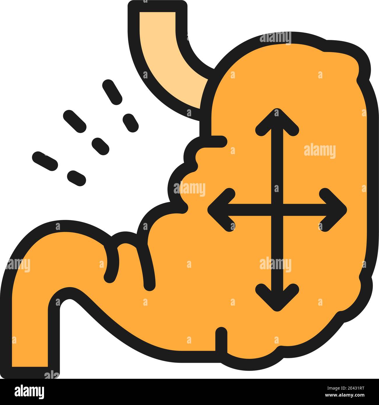 Distended abdomen hi-res stock photography and images - Alamy