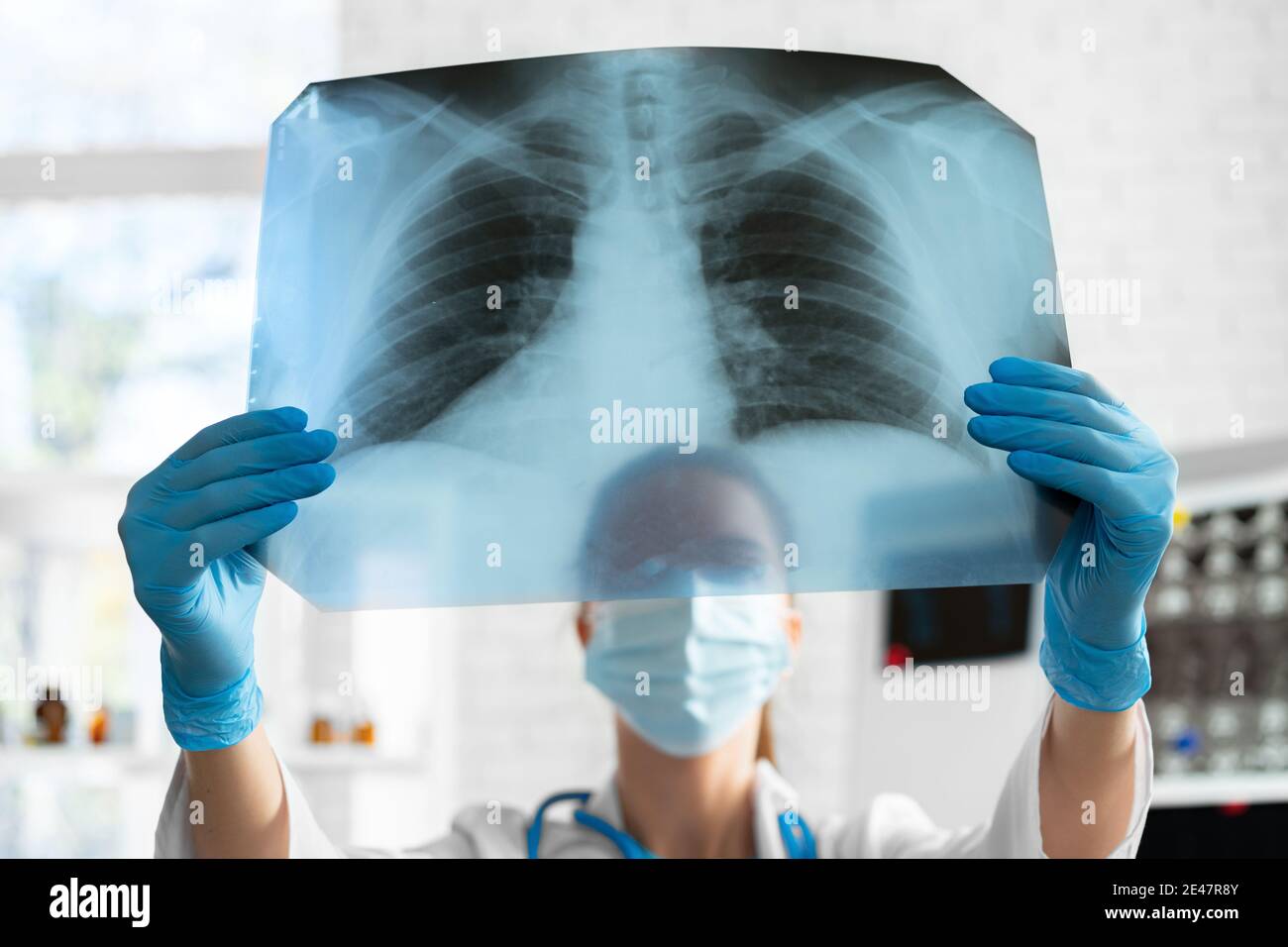 Female doctor in medical mask examines x-ray scan of lungs Stock Photo ...