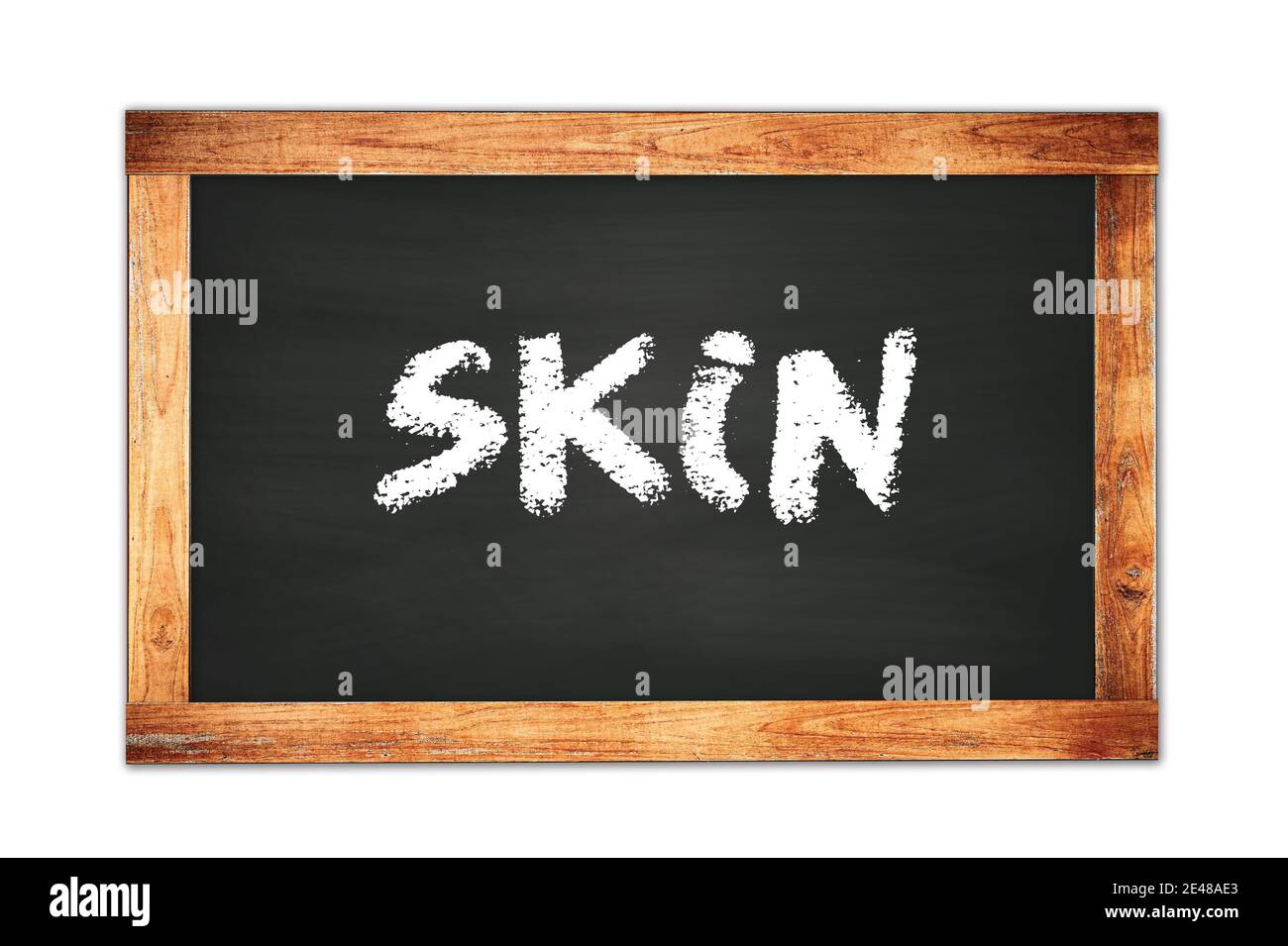 SKIN text written on black wooden frame school blackboard Stock Photo ...