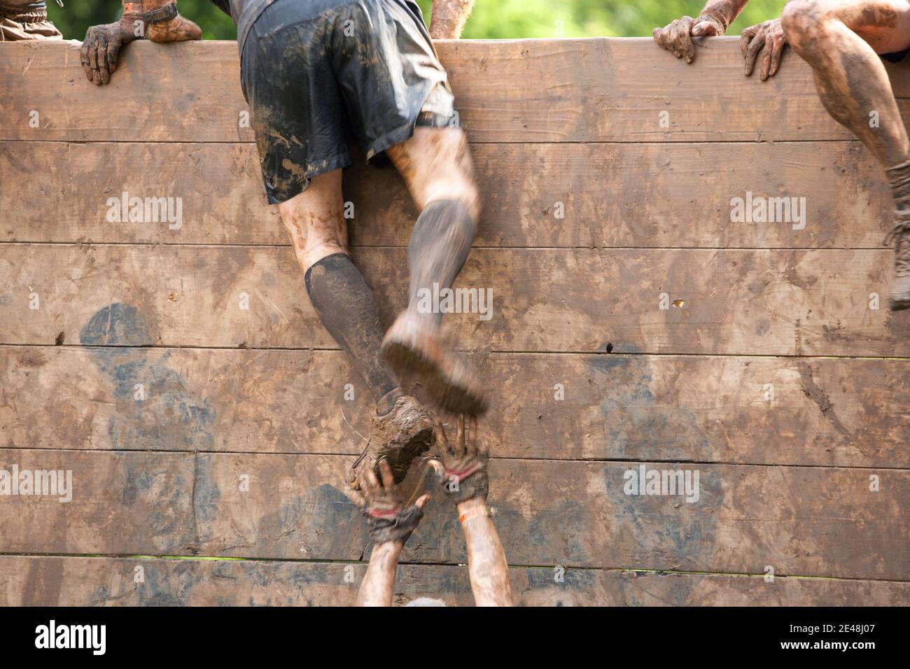 Plastered legs hi-res stock photography and images - Alamy