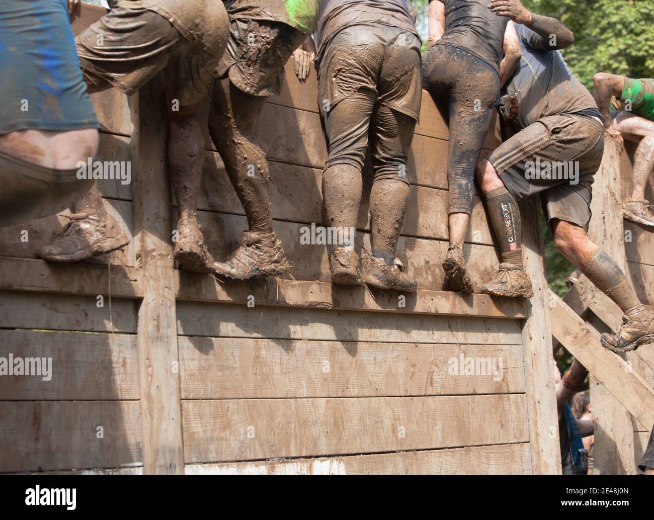 Plastered legs hi-res stock photography and images - Alamy