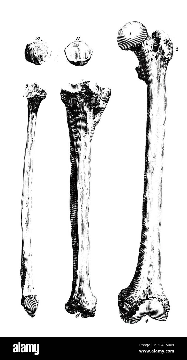Different Types Of Bones