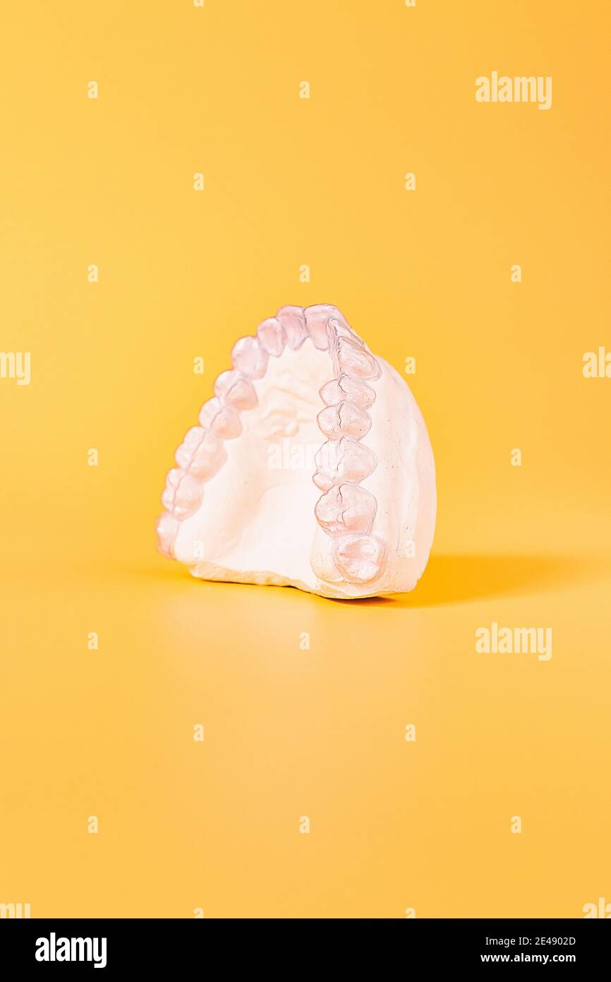 Close-up individual tooth tray Orthodontic dental theme. In hand ...
