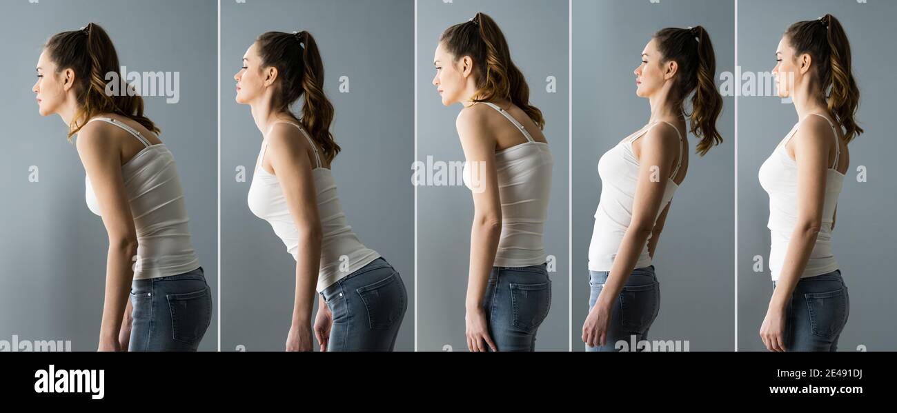Before After Abdominal Body Posture Training And Back Pain Stock Photo ...