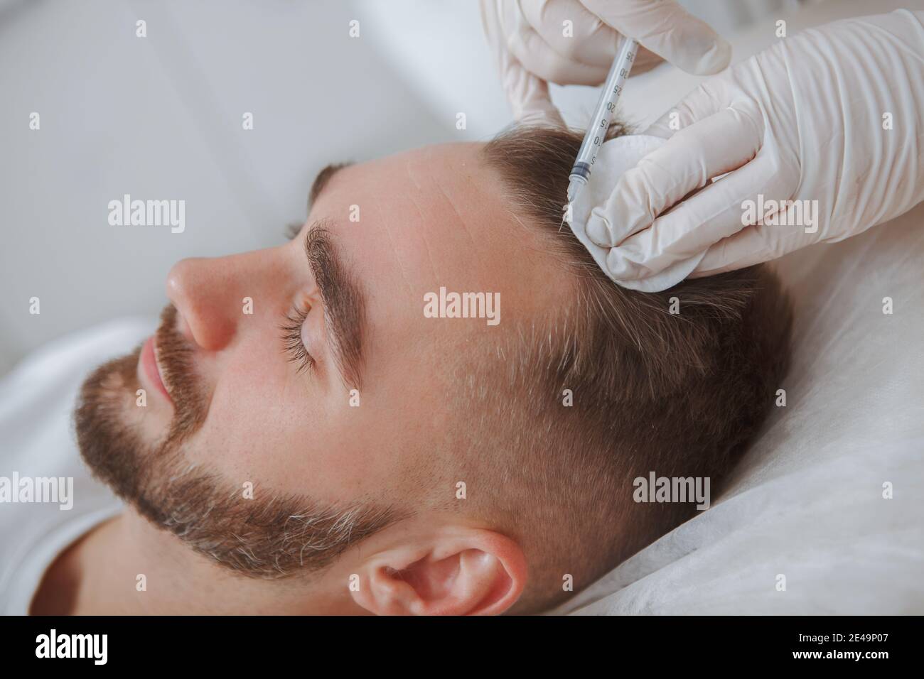 Aesthetician giving hairloss treatment injections into scalp of male ...