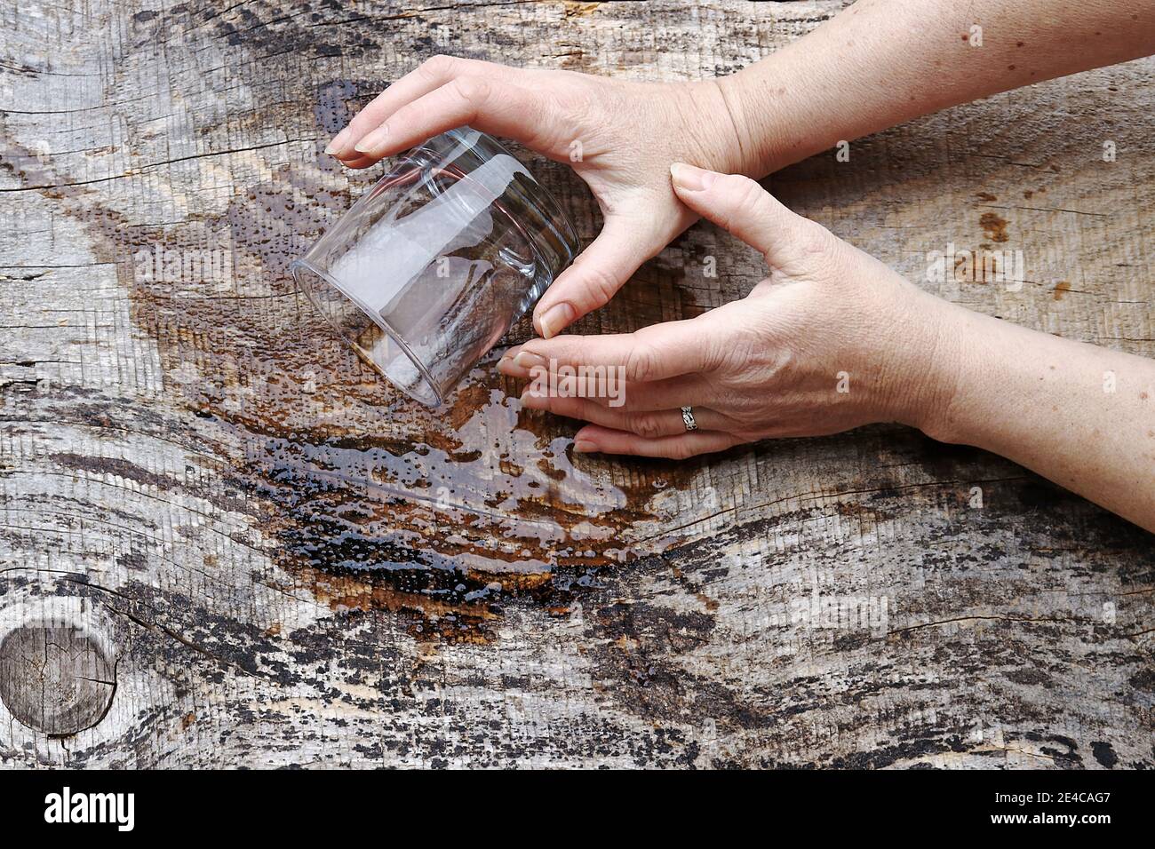 An elderly woman's hands shake so badly that she spills a glass of ...